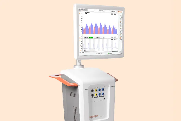 MiraQ™ Cardiac: Precision Cardiac Surgery System | Medistim